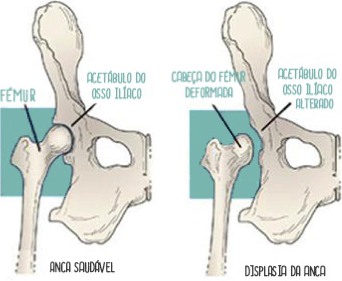 DISPLASIA DE DESENVOLVIMENTO DA ANCA (DDA) - As Nossas Voltas